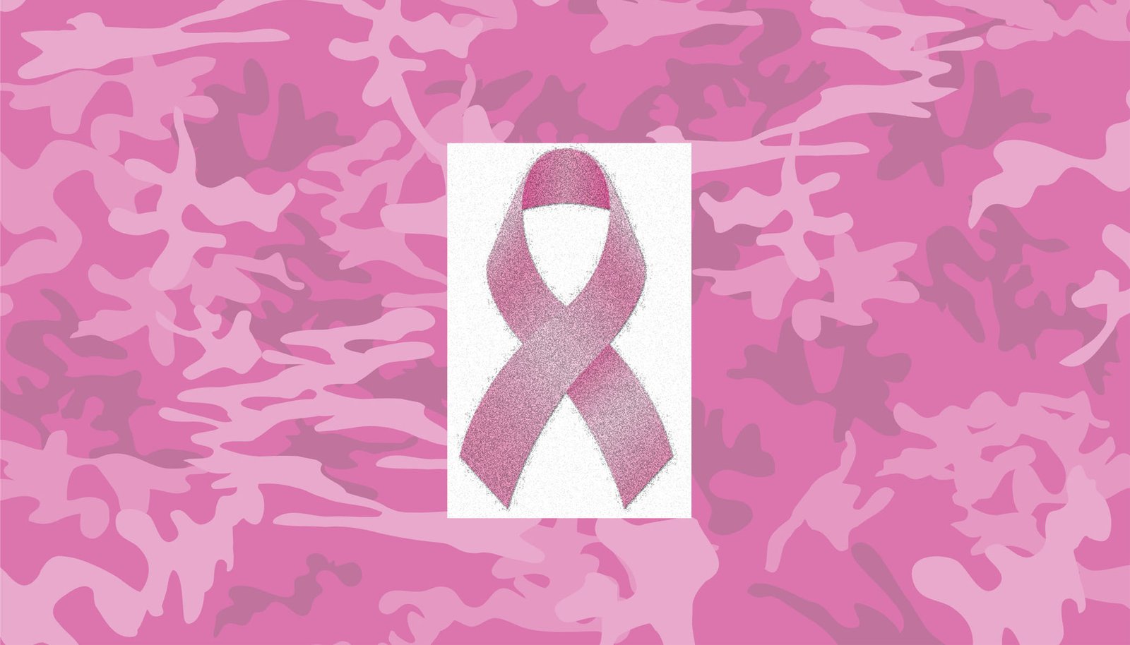 Unilateral Mastectomy Definition